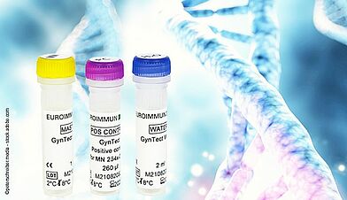 Your partner for the diagnostic laboratory | EUROIMMUN