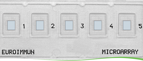 EUROArrayScanner | Euroimmun