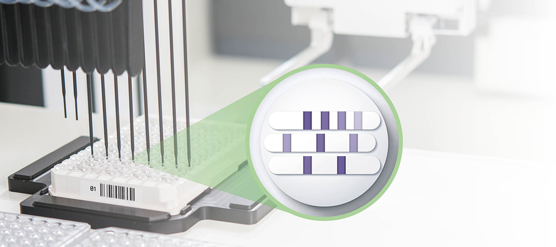 Your partner for the diagnostic laboratory | EUROIMMUN